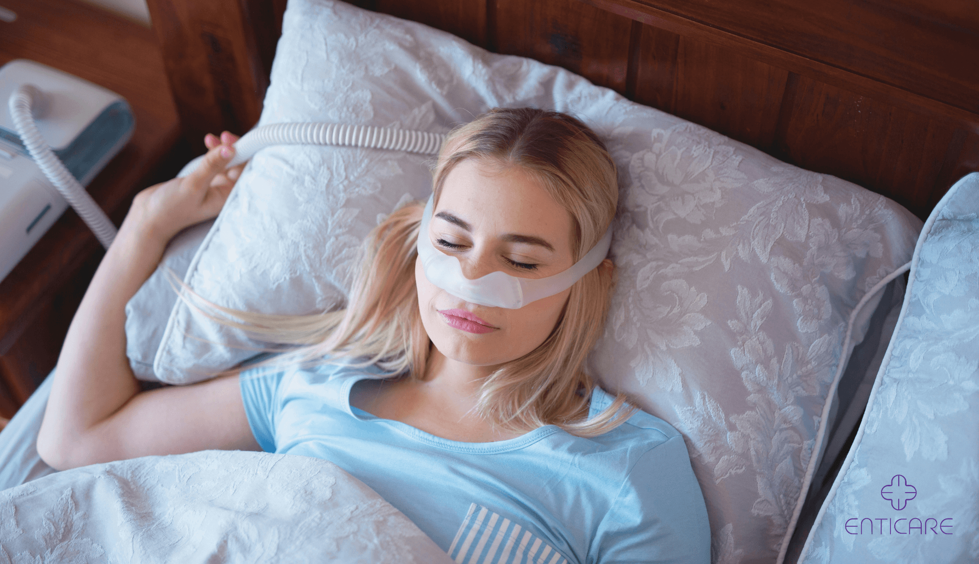 Face Swelling from CPAP: Causes, Prevention Tips & Solutions