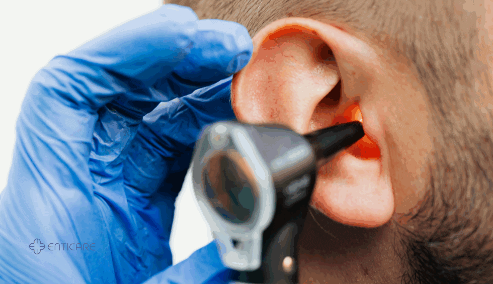 Insect Inside Ear Symptoms: What You Need to Know | Enticare Ear, Nose ...